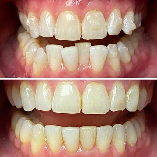 Dental Before and After Transformations in Northridge, CA